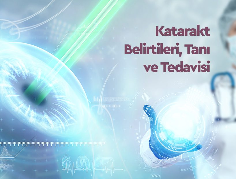 Katarakt Nedir? Belirtileri, Tanısı ve Tedavisi