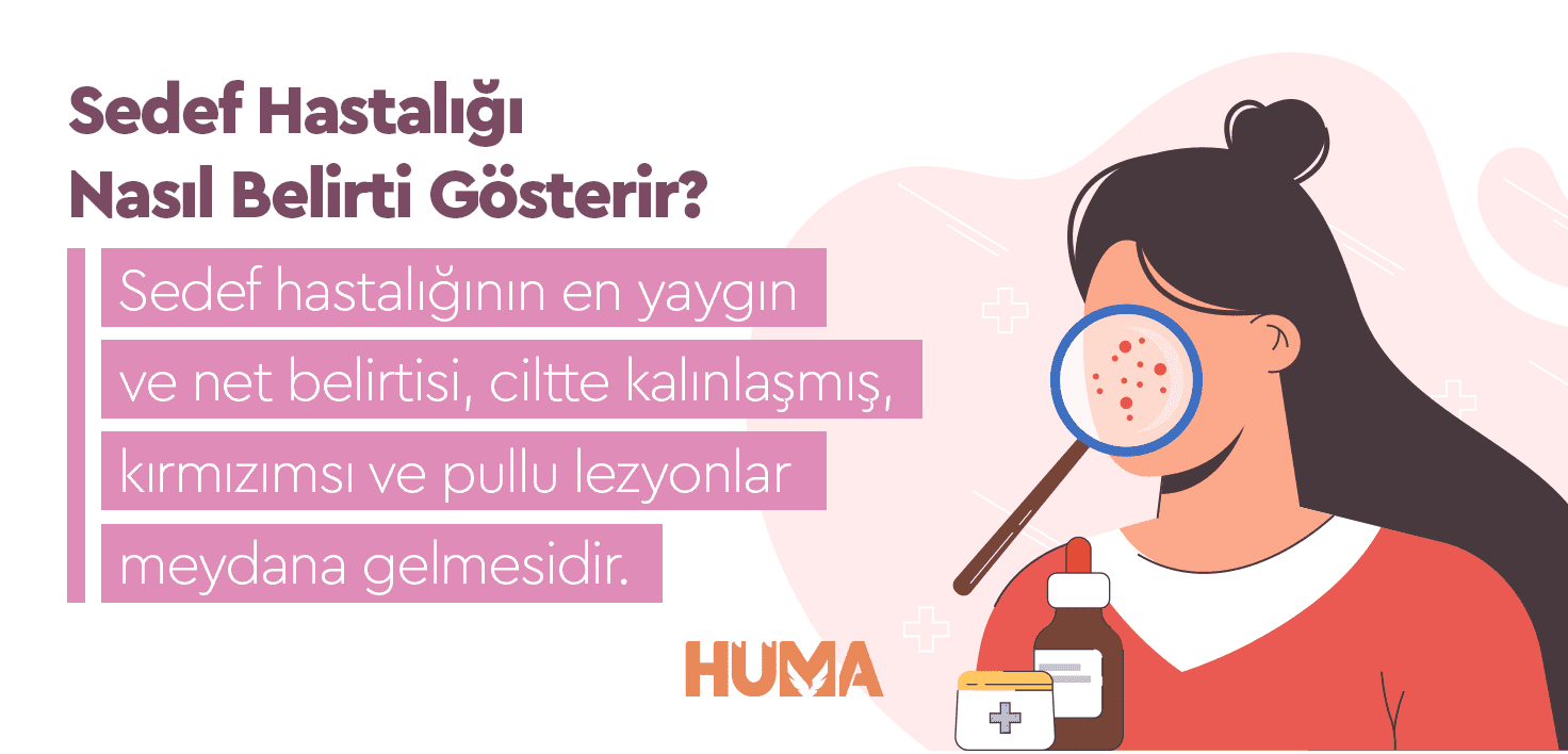 Sedef Hastalığı | Nedir ve Neden Olur? | Hüma Hastanesi