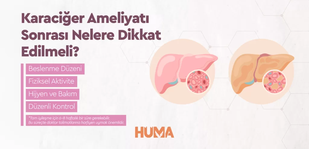 Karaciğer Ameliyatı Nedir? Karaciğer Ameliyatı Nasıl Yapılır?